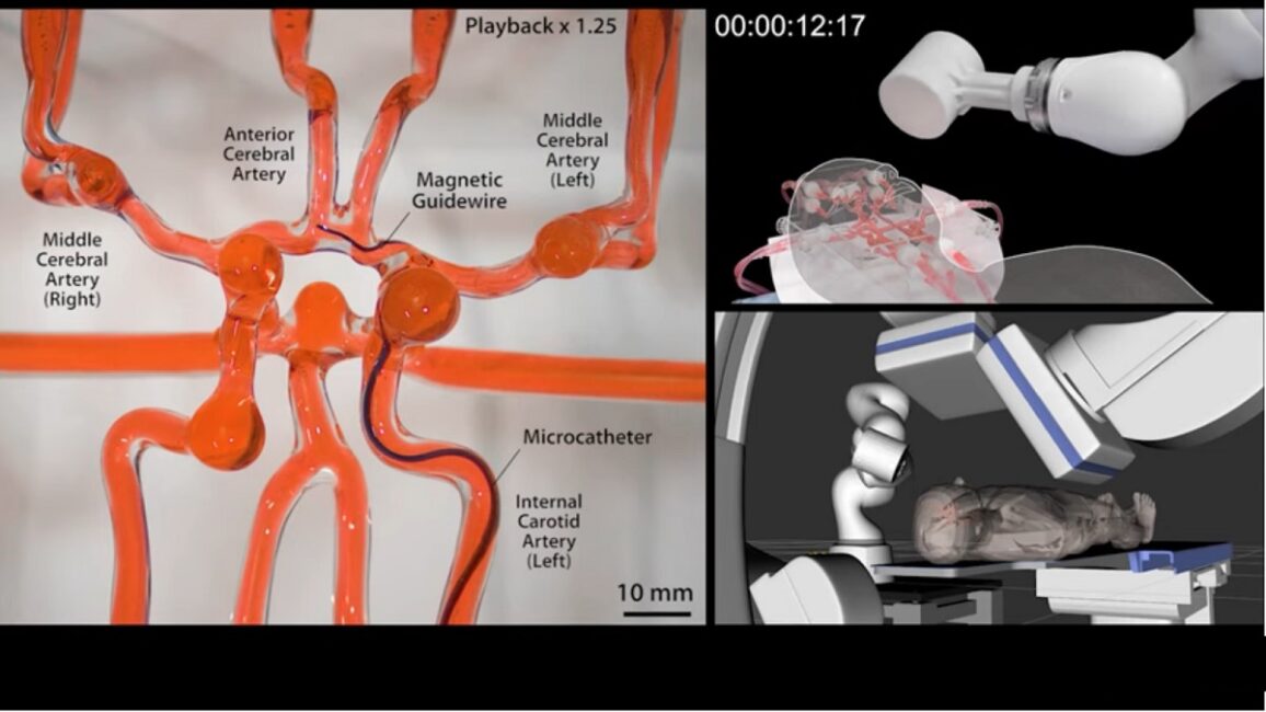 MIT has created a robot to treat stroke patients - Root-Nation.com